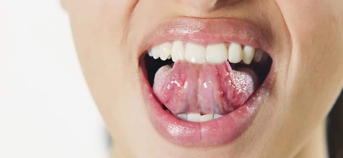 Cepillado Infantil Cómo Debe Ser Según La Edad Ferrusandbratos