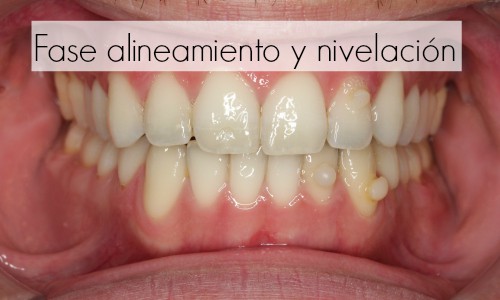 FASES DE LA ORTODONCIA