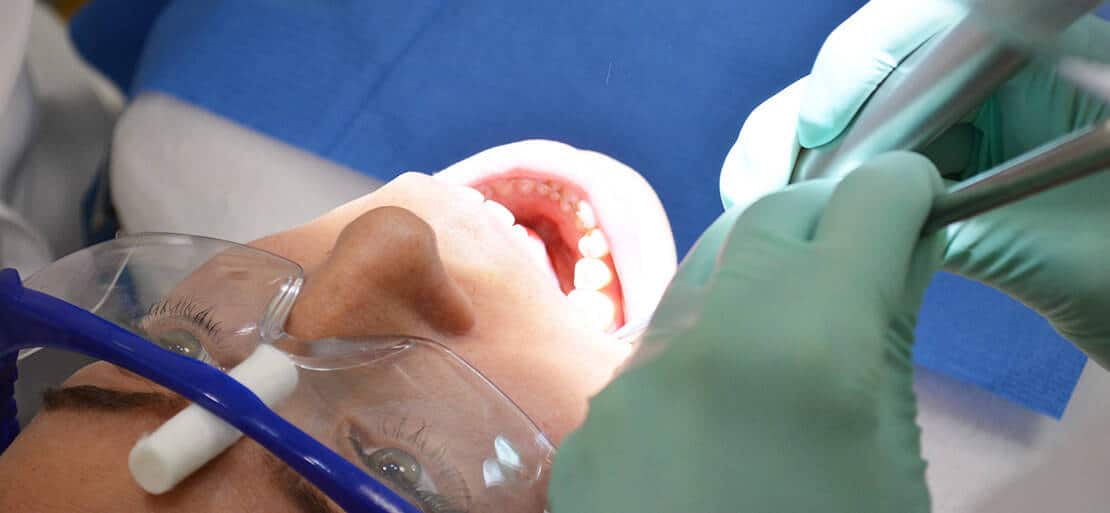 Muela rota: ¿cómo se puede tratar? | Ferrus&Bratos