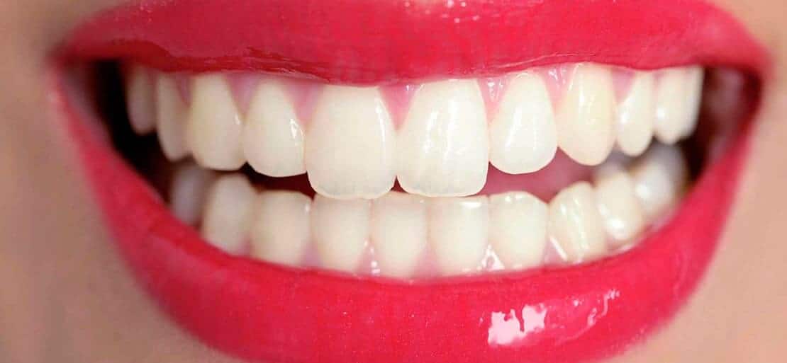 Mordida u oclusión dental: problemas y soluciones | Ferrus&Bratos