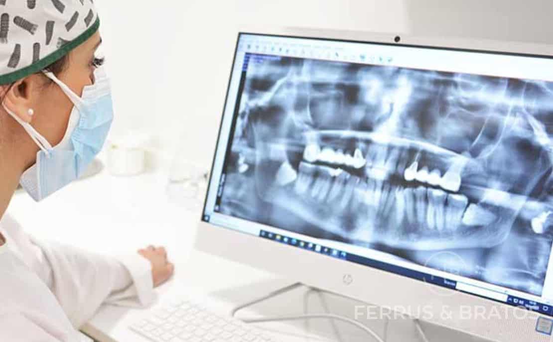 Anquilosis dental: Causas y tratamiento | Ferrus&Bratos