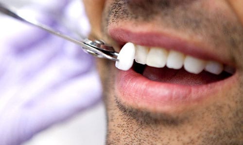 Microdoncia y macrodoncia: anomalías de tamaño en dientes