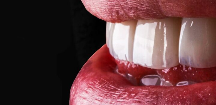 Gingivitis úlceronecrosante o GUNA: tratamiento | Ferrus&Bratos