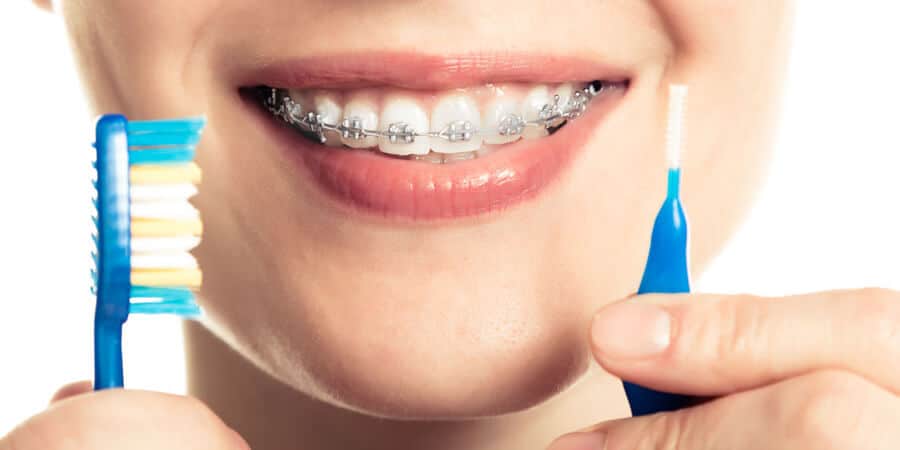 ¿Qué alimentos comer y NO comer con brackets? | Ferrus&Bratos