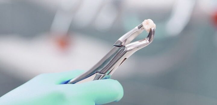 Tengo una muela infectada: ¿cómo se cura y qué remedios caseros hay?