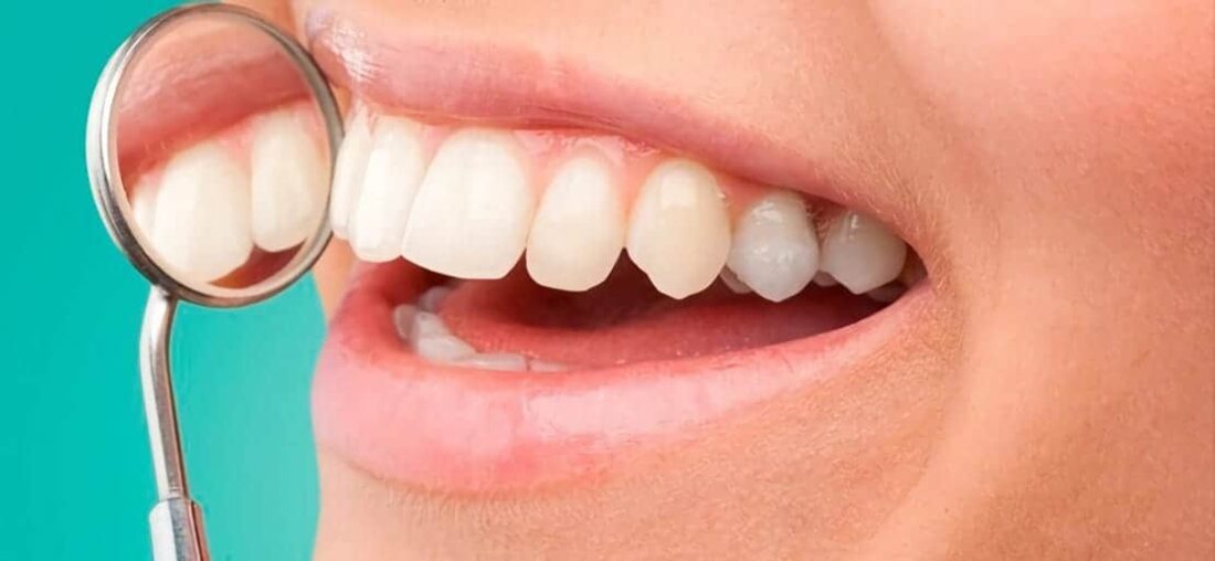 Encías: la importancia de mantenerlas sanas | Ferrus&Bratos