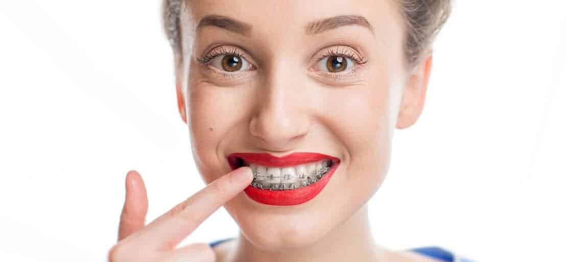 Ortodoncia para adultos: ¿hasta qué edad puedo llevar ortodoncia?