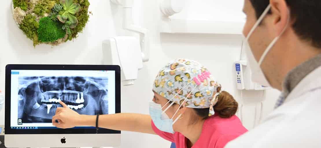 Dientes supernumerarios: causas y tratamiento | Ferrus&Bratos