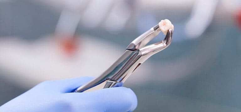 Alveolitis dental: tipos y cómo prevenir su aparición | Ferrus&Bratos