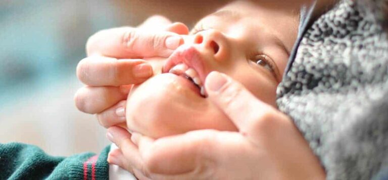 Frenillo de la boca: ¿cuándo hay que operarlo? | Ferrus&Bratos