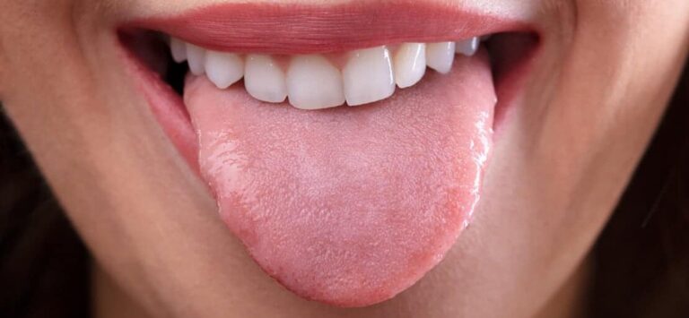 Lengua: características, funciones y patologías | Ferrus&Bratos