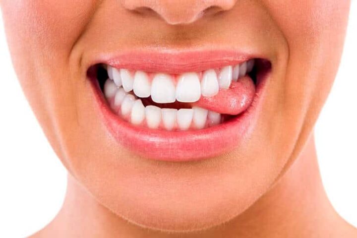 Microglosia: ¿qué problemas genera? ¿Hay tratamiento? | Ferrus&Bratos