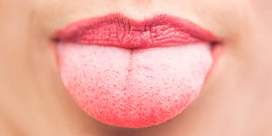 Enfermedades de la lengua más comunes (y su solución) | Ferrus&Bratos