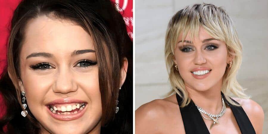 Famosos con carillas dentales y no lo sabías | Ferrus&Bratos