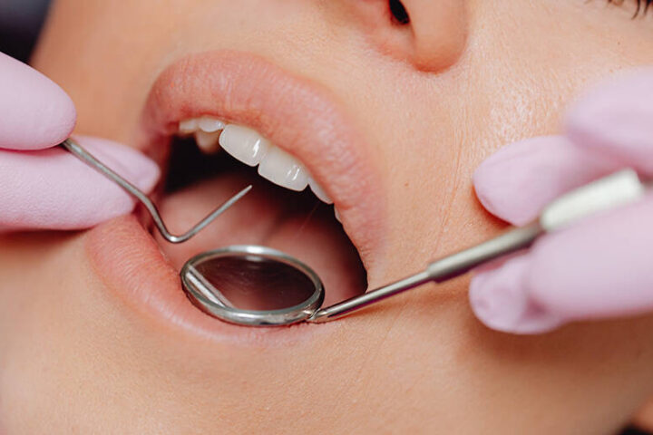 Muela rota: ¿cómo se puede tratar? | Ferrus&Bratos