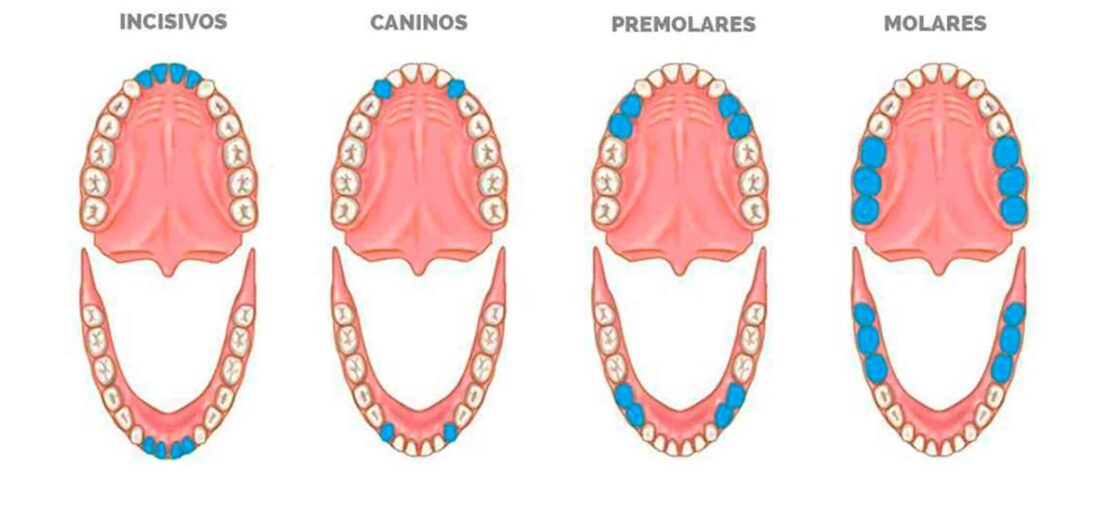 Nombres de los dientes: ¿cómo se llama cada uno? | Ferrus&Bratos