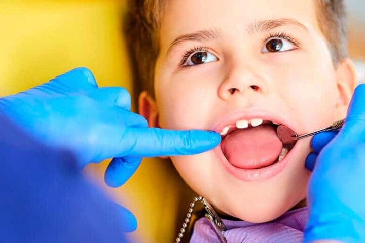 Ferrus&Bratos • Paladar ojival en bebés: ¿hay que tratarlo?