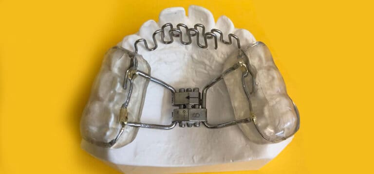 Ortodoncia removible para niños y adultos | Ferrus&Bratos