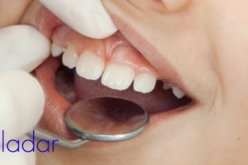 Nombres de los dientes, descubre como se llama cada diente