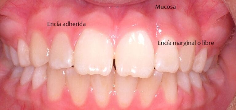 Ferrus&Bratos • Tipos de encía y los cuidados que necesitan
