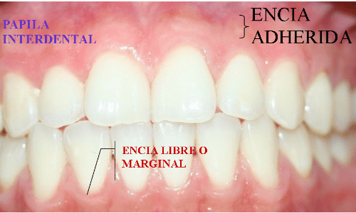 Tipos de encía y enfermedades que la afectan- Ferrus & Bratos