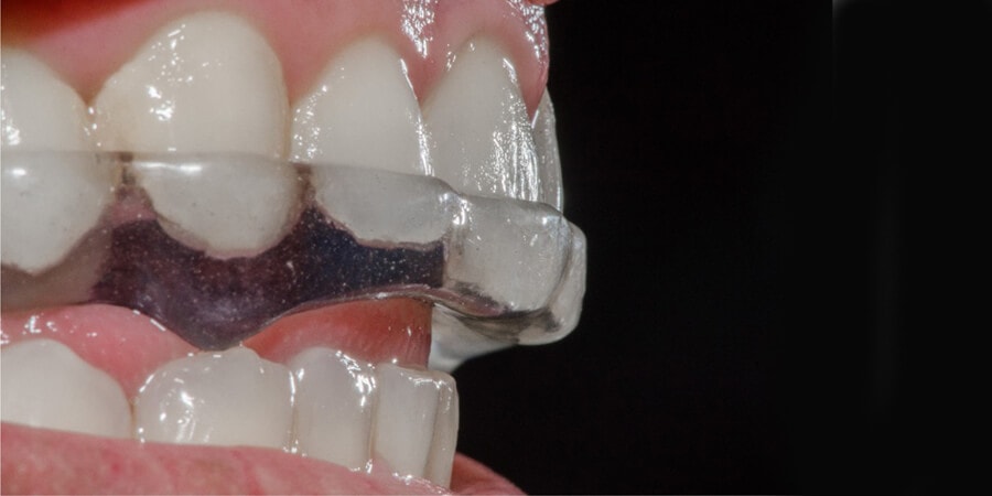 Férula de descarga: precio en 【 2026 】Ferrus&Bratos