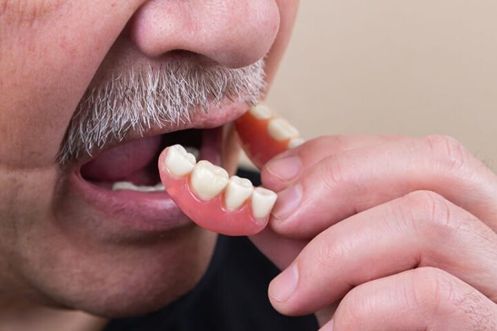 El precio de una dentadura postiza | 2025 | Ferrus&Bratos