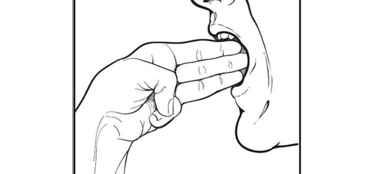 Trismus dental: causas y tratamiento | Ferrus&Bratos