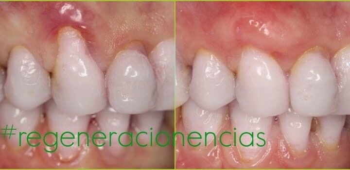 Labios hinchados: causas y soluciones | Ferrus&Bratos