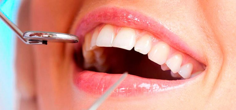 Liquen plano oral: diagnóstico y tratamiento | Ferrus&Bratos