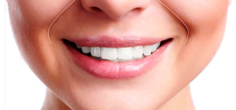 El surco nasogeniano, ¿por qué aparece y cómo prevenirlo?