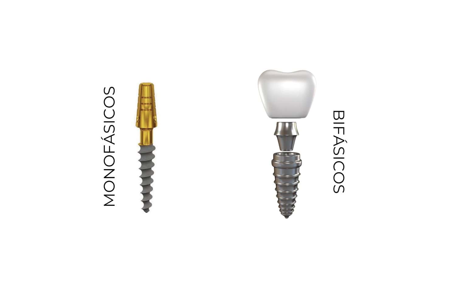 Implantes monofásicos: ventajas y desventajas | Ferrus&Bratos