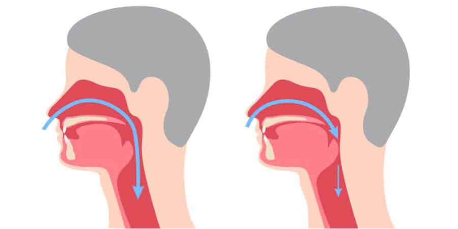 OrthoApnea: la solución a la apnea y los ronquidos | Ferrus&Bratos